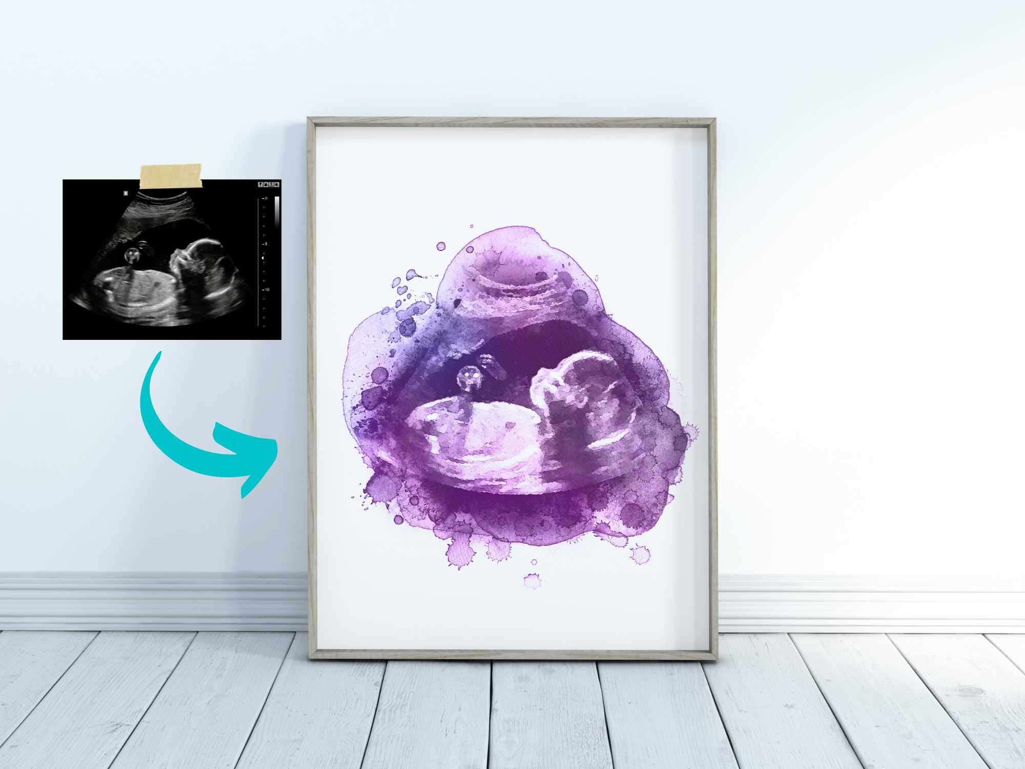 Custom Sonogram Digital Painting – Ultrasound Watercolor Shape ...
